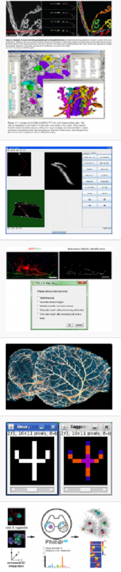 Resources | Tulane Brain Institute